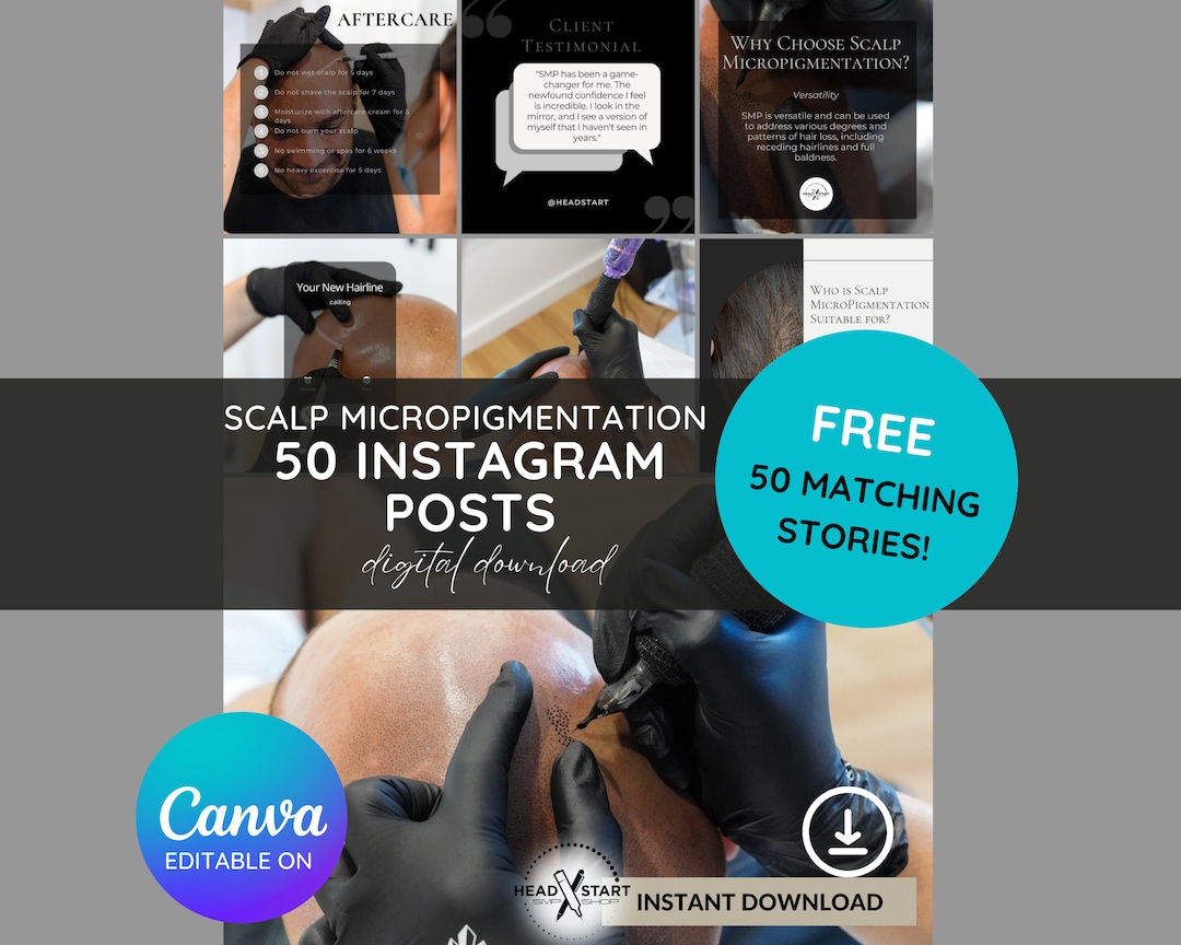 Scalp Micropigmentation Social Media Templates Instagram Template SMP ...
