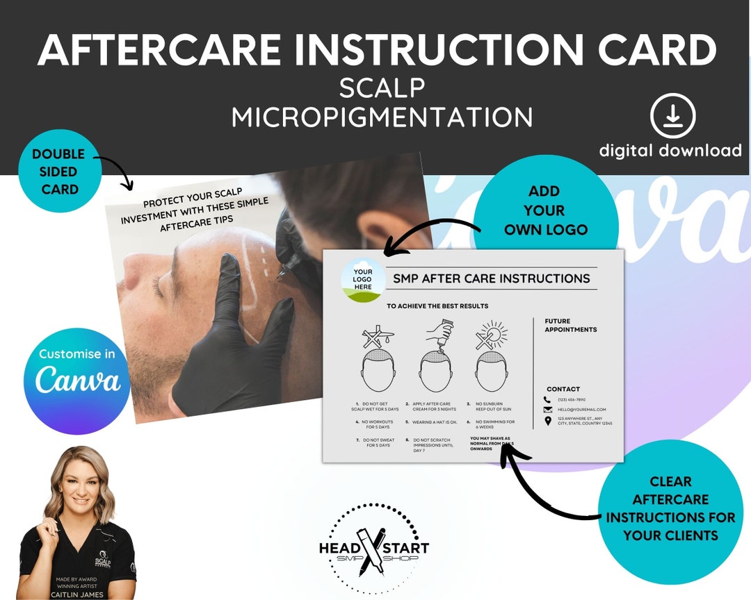 Scalp Micropigmentation Aftercare Card: SMP Expert Tips (digital ...