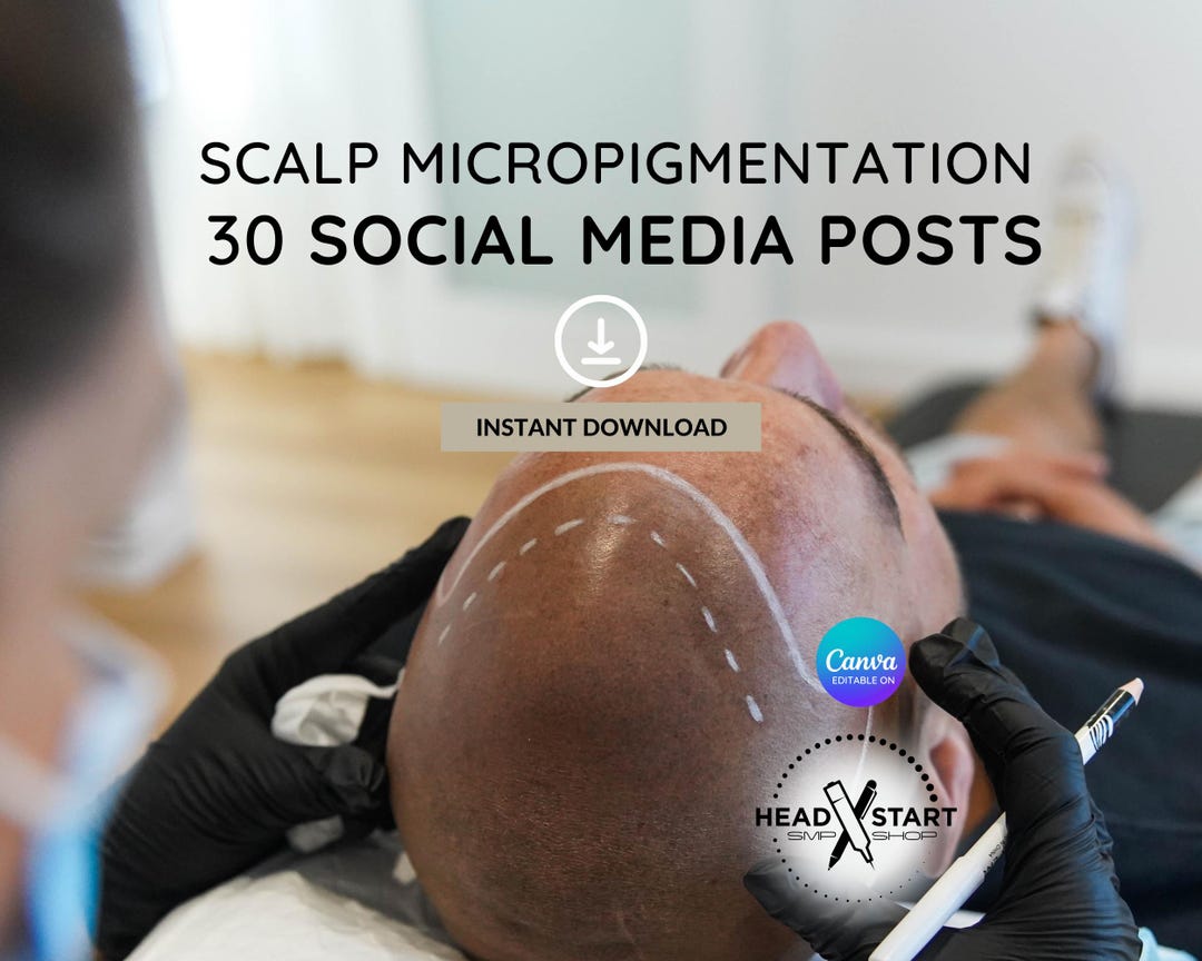 Scalp Micropigmentation Social Media Templates Instagram Template SMP ...