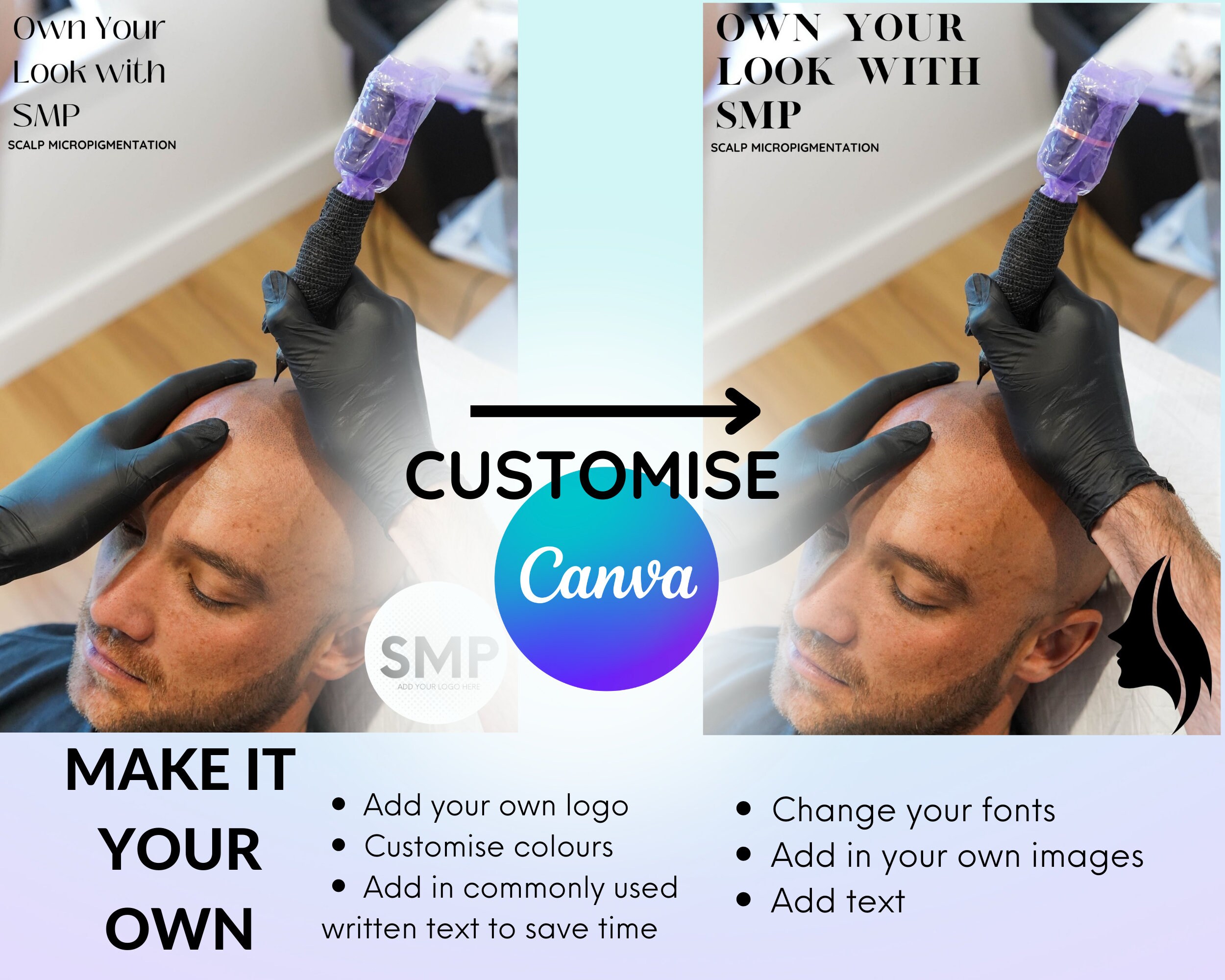 Scalp Micropigmentation (SMP) Poster, Instant Download in Jpeg or PDF ...