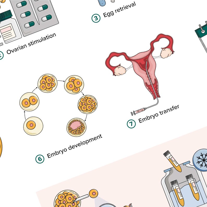 IVF Image Bundle: in Vitro Fertilization Anatomy Art (digital Download ...