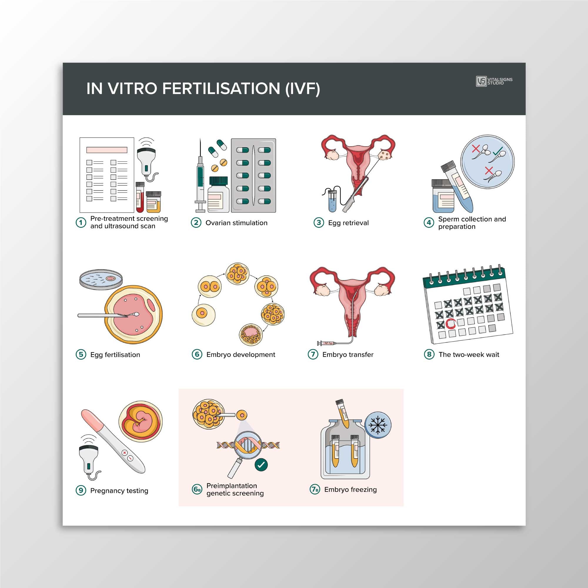 IVF Image Bundle: in Vitro Fertilization Anatomy Art (digital Download ...