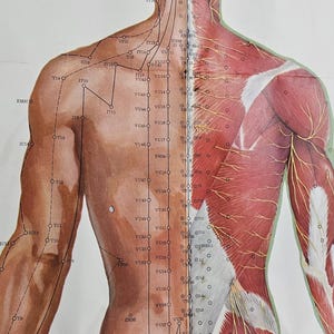 Vintage Acupuncture Anatomical Chart – Medical Wall Poster With ...