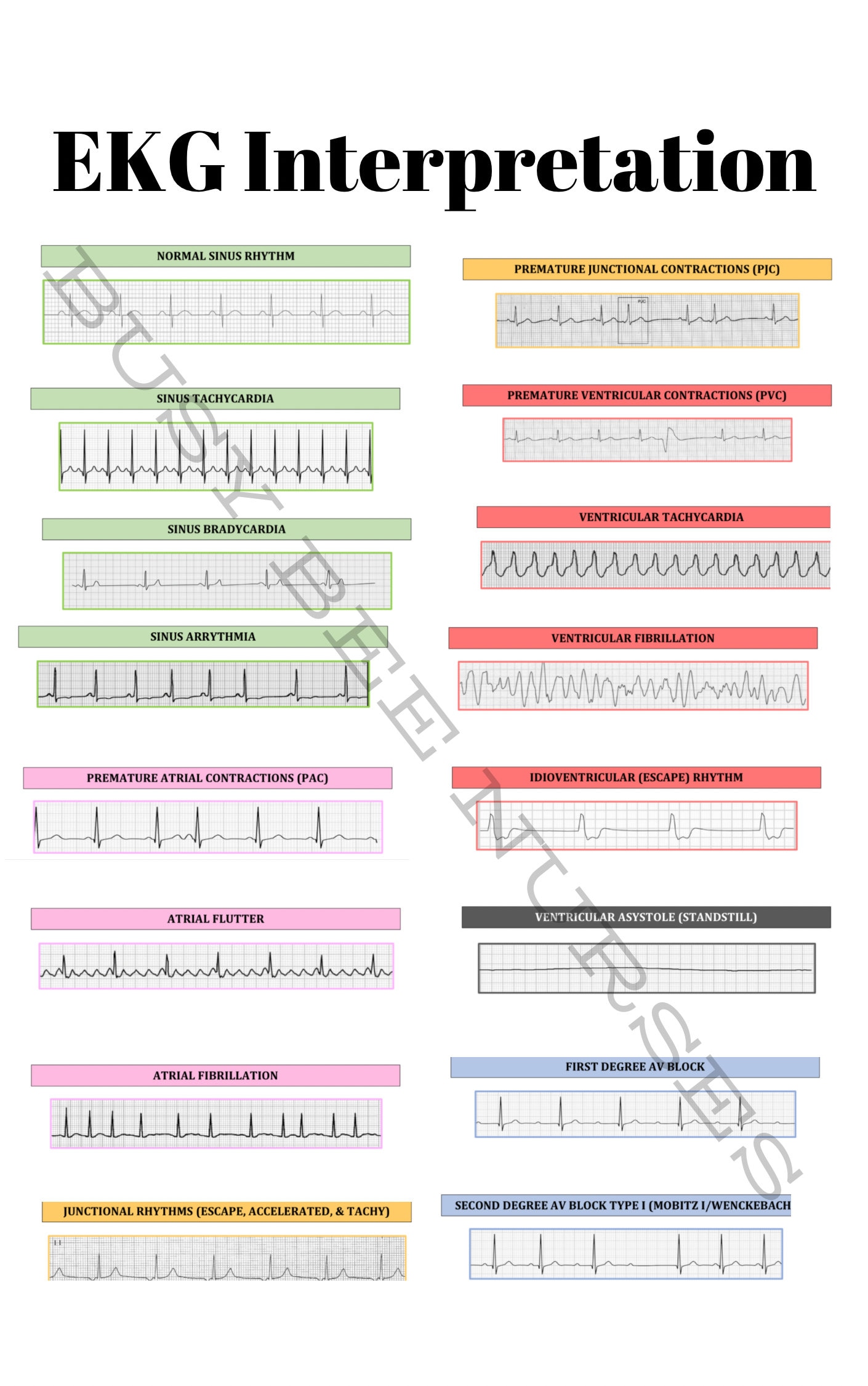EKG Interpretation - Etsy