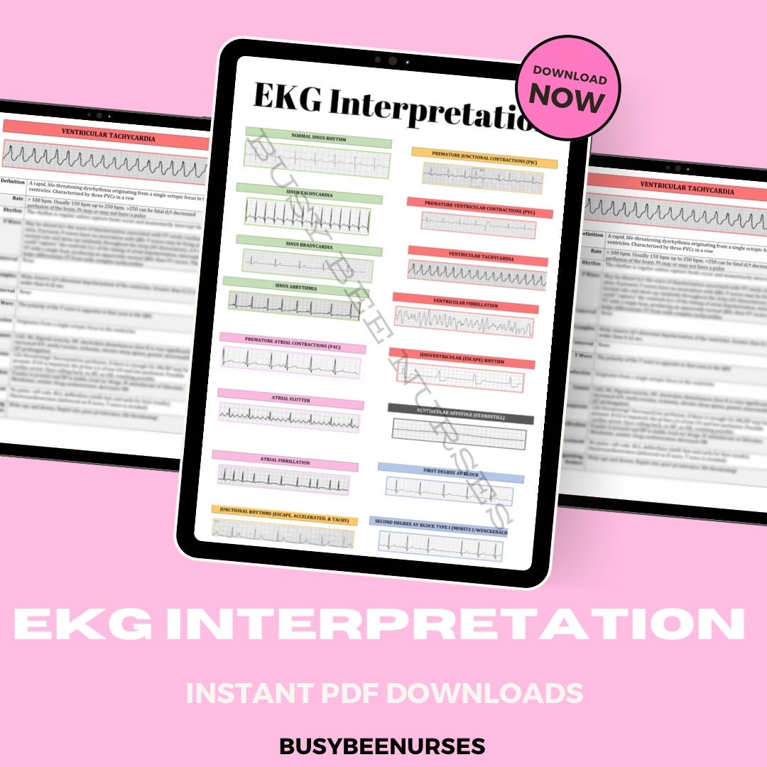 EKG Interpretation - Etsy