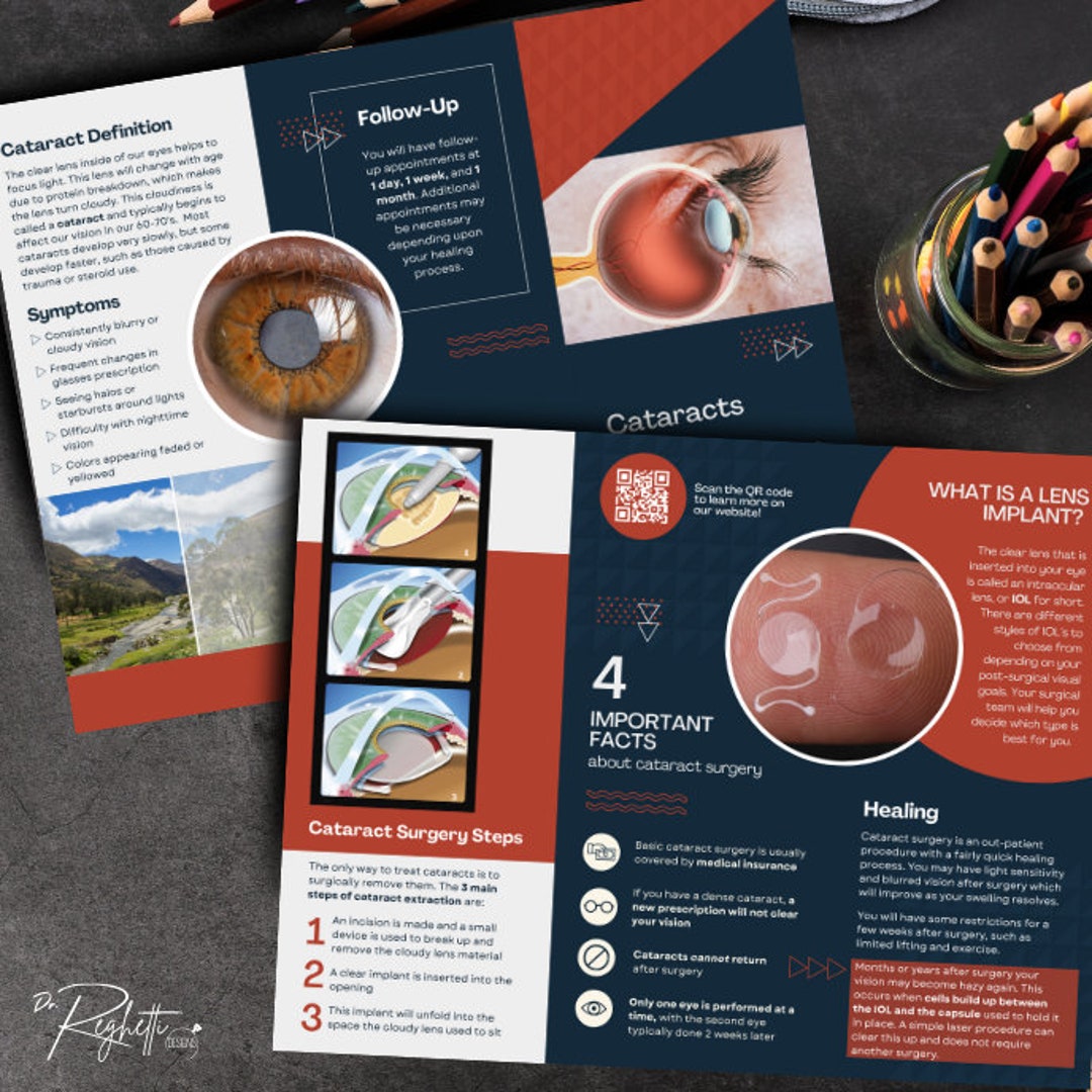 Cataract Brochure - Etsy
