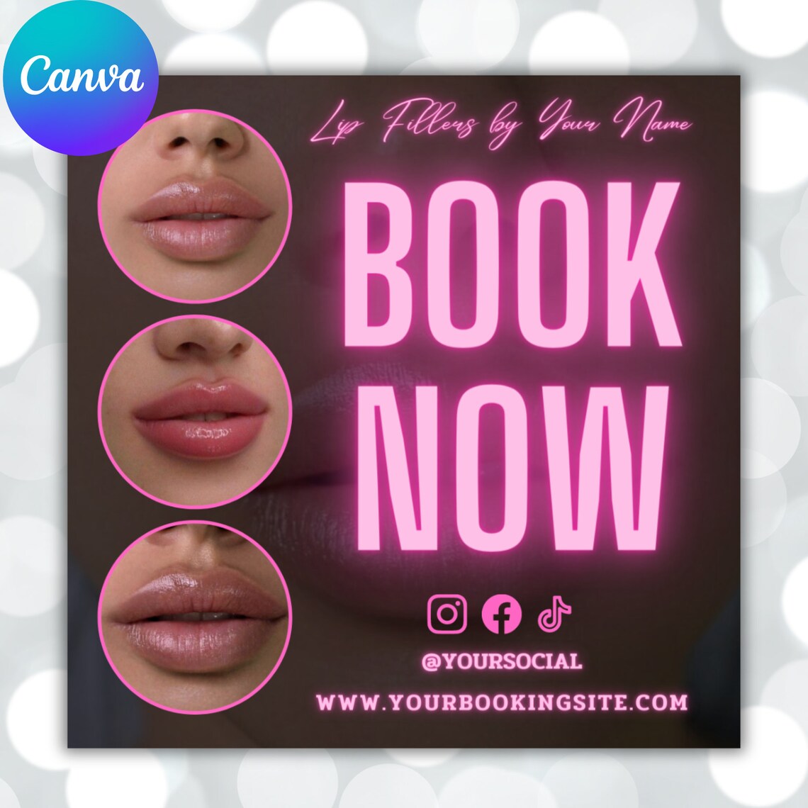 Lip Fillers Flyer Template,editable Canva Flyer, Botox Fillers E-flyer ...