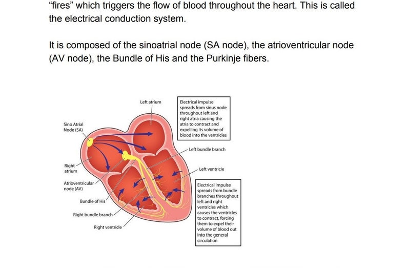 Understanding Ekgs Guide - Etsy