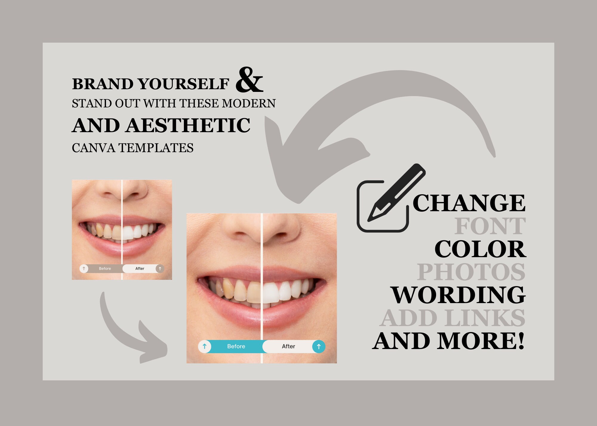 Teeth Whitening Instagram Template Teeth Whitening Social Media Post ...