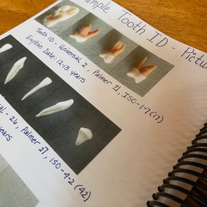 The Comprehensive Dental Hygiene Study Sheets Complete Bundle - Etsy