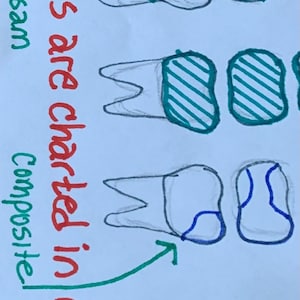 Hard Tissue Dental Charting Basics for the Dental Student - Etsy