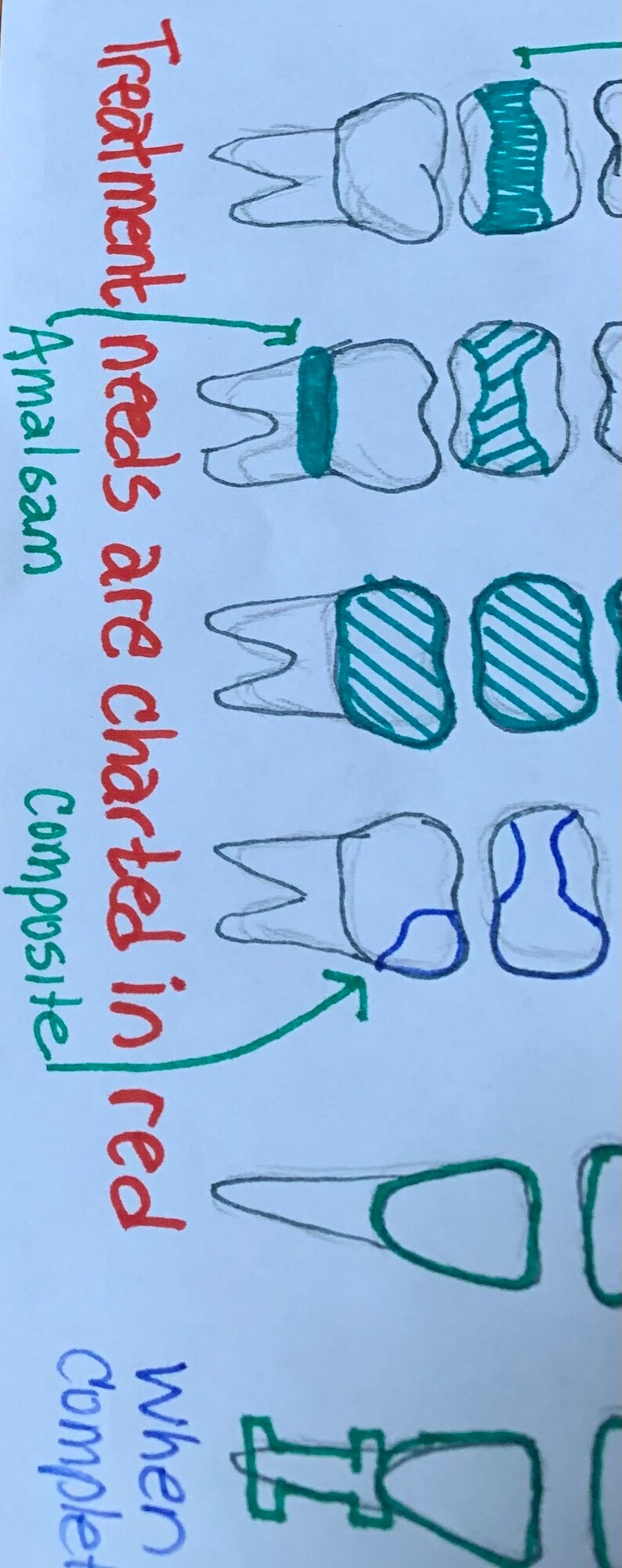 Hard Tissue Dental Charting Basics for the Dental Student - Etsy