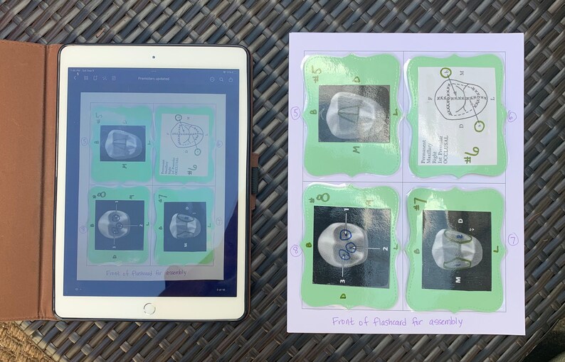 Dental Flashcards Premolar Tooth Morphology for Dental Hygiene Students ...