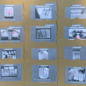 Radiology Bundle Study Sheets for Dental Students - Etsy