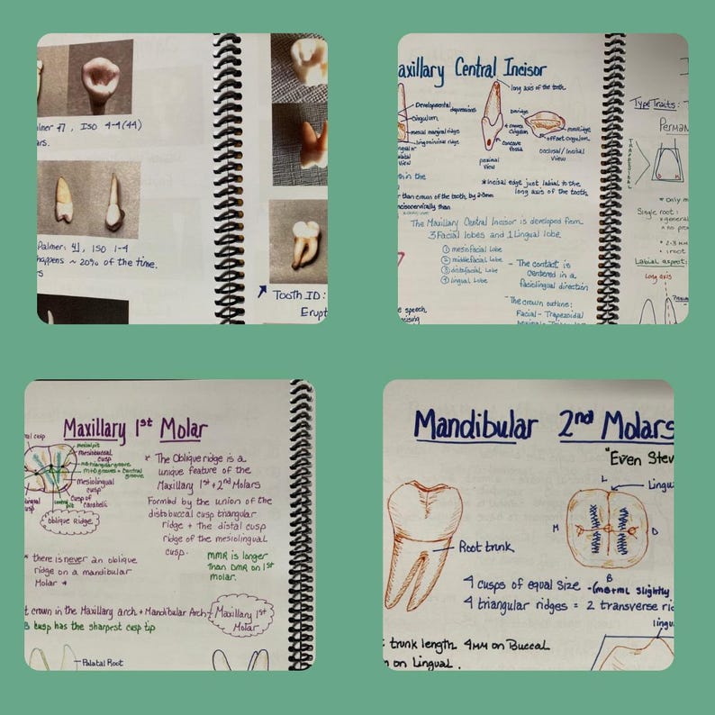 Dental Anatomy Spiralbound Color Tooth Morphology Entire Dentition for ...