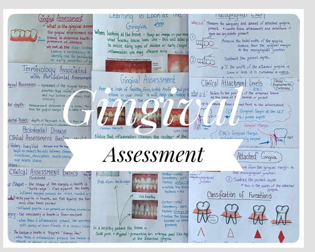 Gingival Assessment Basics Study Notes for the Dental Hygiene Student ...