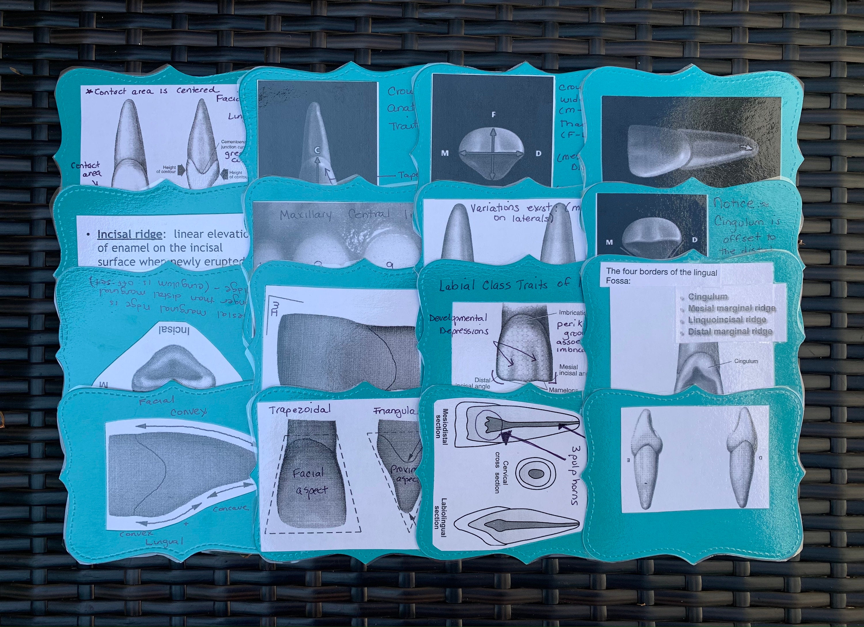 Dental Flashcards Incisor Tooth Morphology for Dental Hygiene Students ...