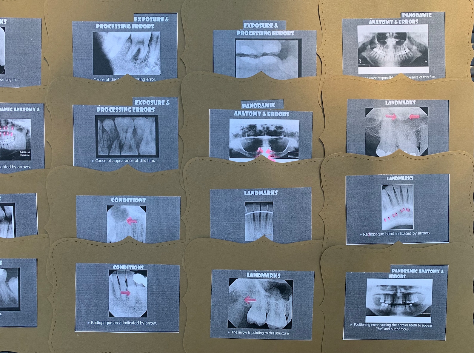Dental Radiology Flashcards on Conditions and Anatomy - Etsy