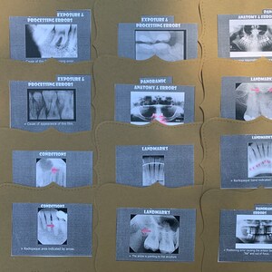 Dental Radiology Flashcards on Conditions and Anatomy - Etsy