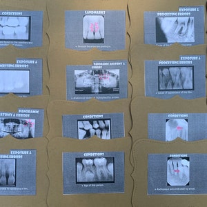 Dental Radiology Flashcards on Conditions and Anatomy - Etsy