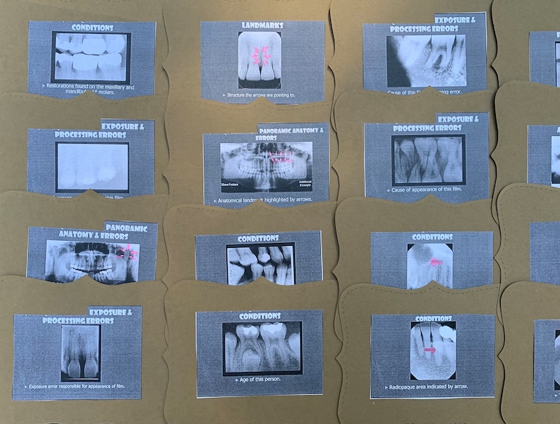 Dental Radiology Flashcards on Conditions and Anatomy - Etsy