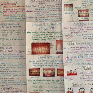 Gingival Assessment Basics Study Notes for the Dental Hygiene Student ...
