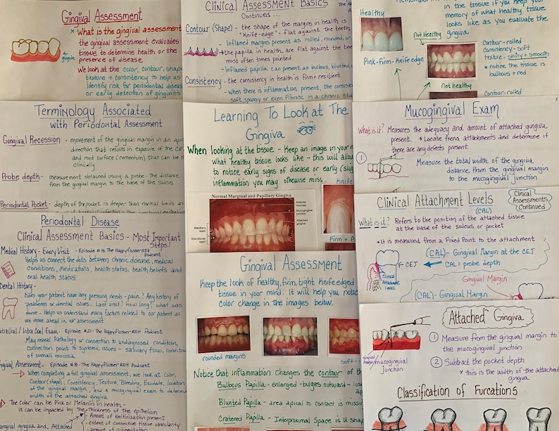 Gingival Assessment Basics Study Notes for the Dental Hygiene Student ...