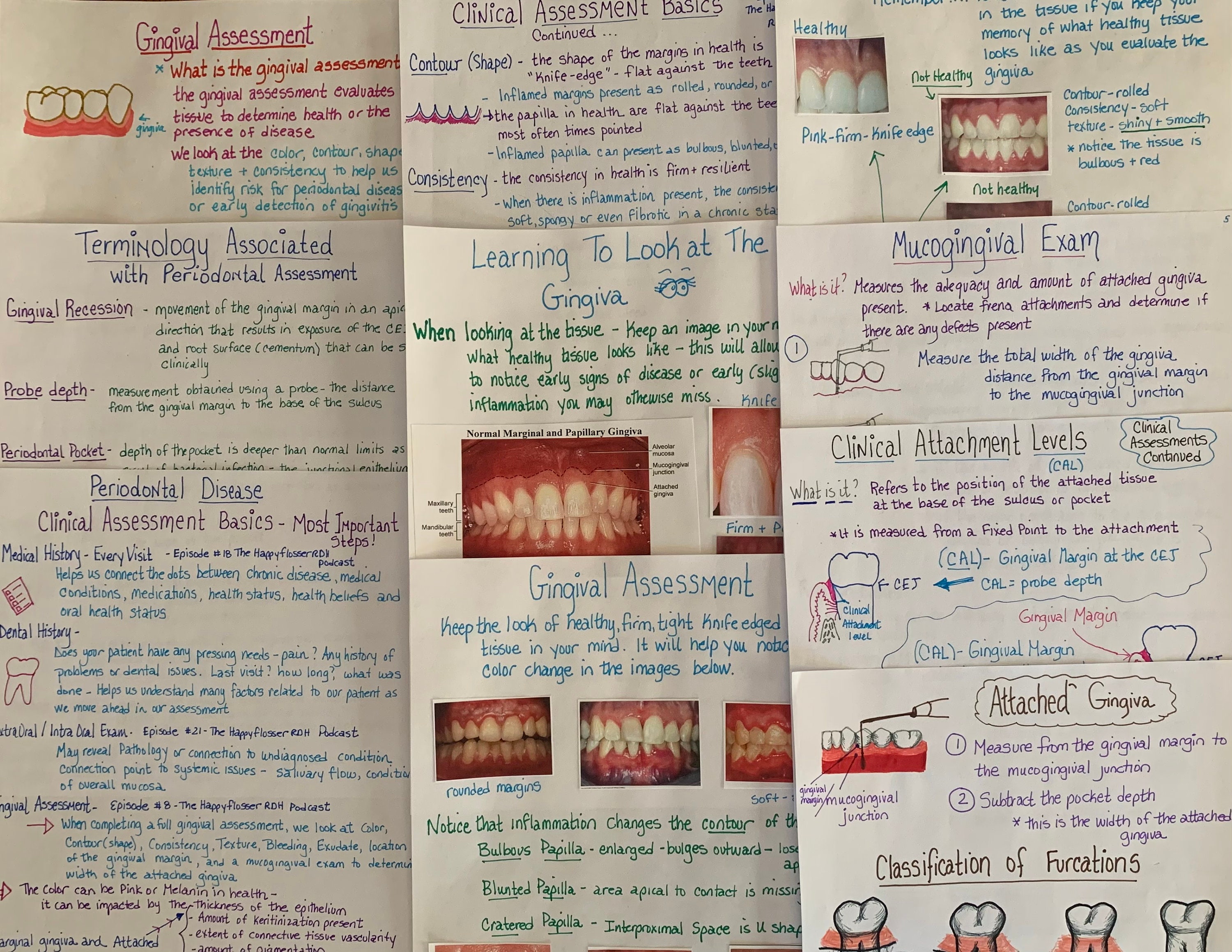 Gingival Assessment Basics Study Notes for the Dental Hygiene Student ...