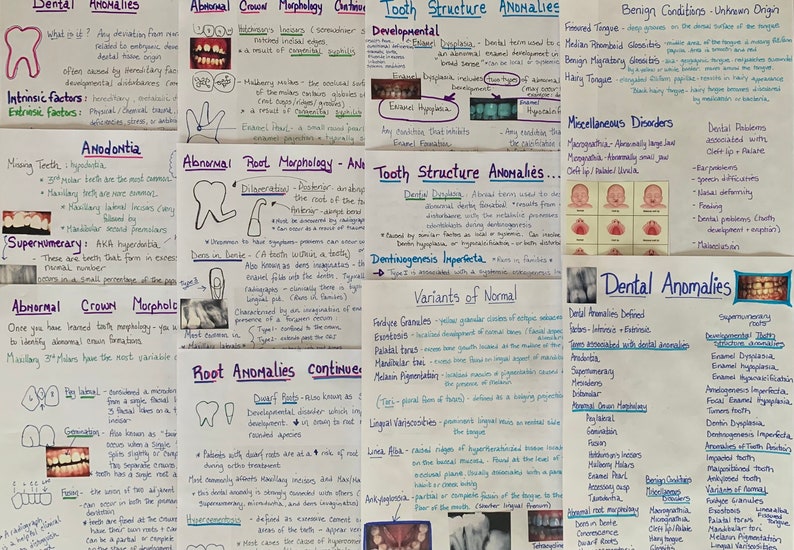 Anomalies in Dental - Study Sheets for Dental Hygiene Students - Etsy