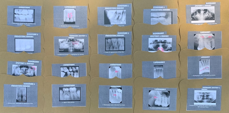 Dental Radiology Flashcards on Conditions and Anatomy - Etsy
