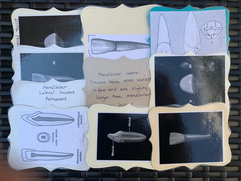 Dental Flashcards Incisor Tooth Morphology for Dental Hygiene Students ...