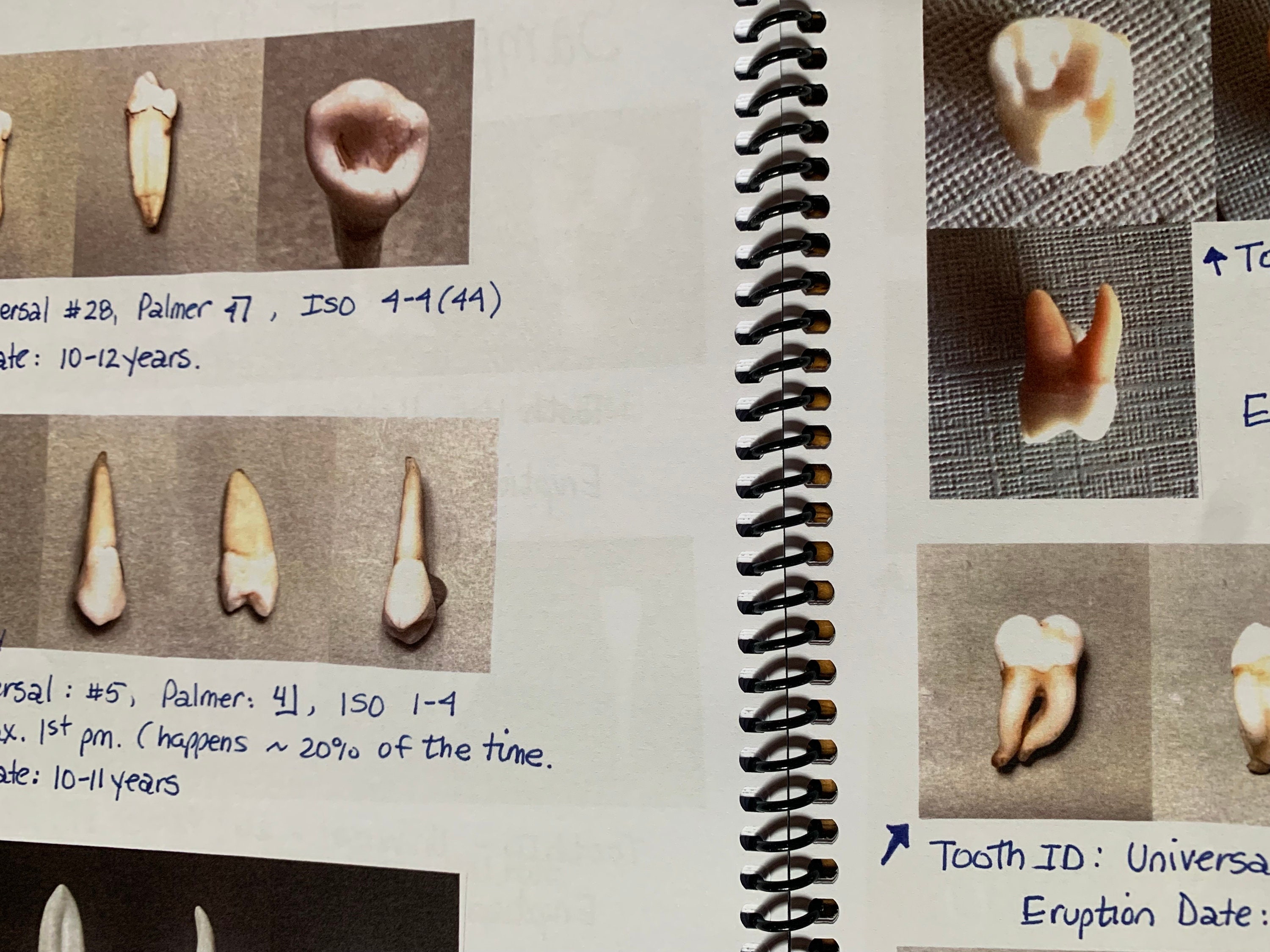 Dental Anatomy Spiralbound Color Tooth Morphology Entire Dentition for ...