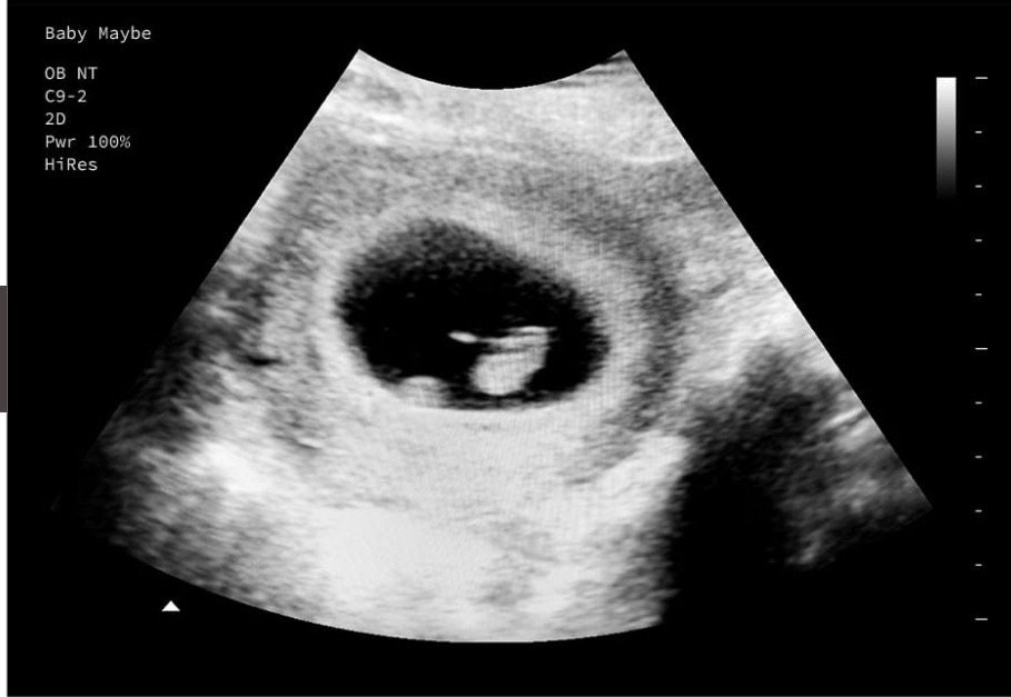 Fake Ultrasounds digital - Etsy