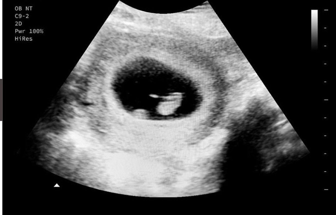 Customizable Fake Digital Ultrasound Prank Gift. Fake Ultrasounds ...