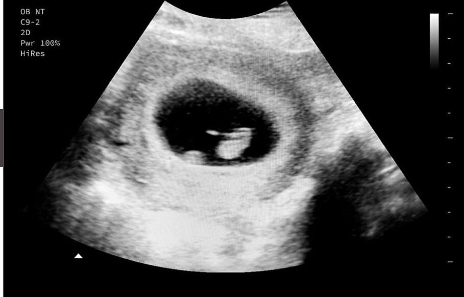 Customizable Fake Digital Ultrasound Prank Gift. Fake Ultrasounds ...