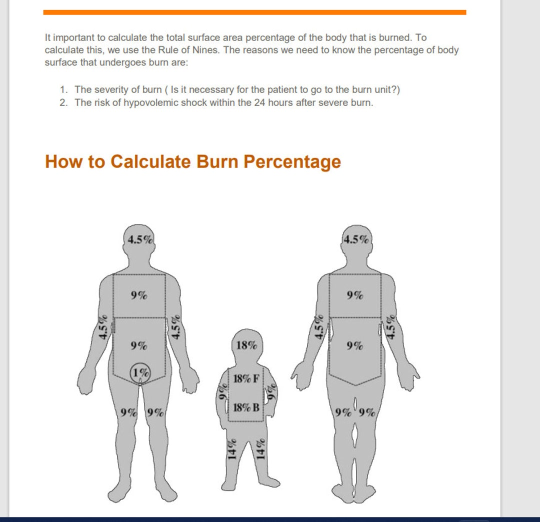 Rules of Nine's Worksheet - Etsy