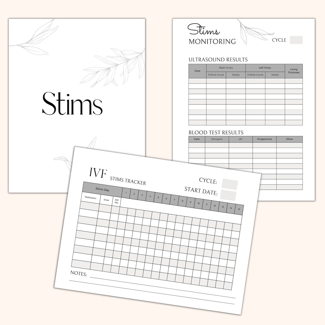 Printable IVF Planner, Minimalistivf Journal, IVF Calendar- Keep Track ...