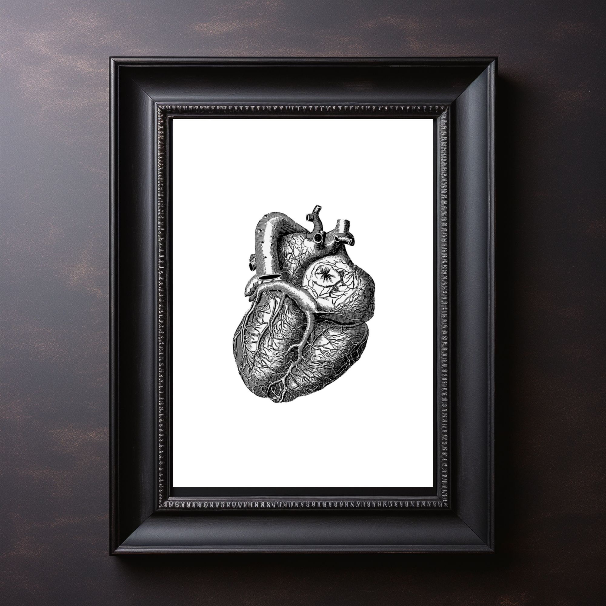 Coronary Anatomy Poster of the Heart, Vintage Anatomical Heart Print ...