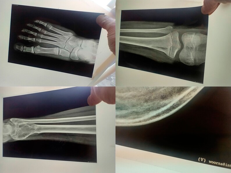 X-RAY Human Skeleton Puzzle Light Box Art Bones 230x159mm X22 Pieces ...