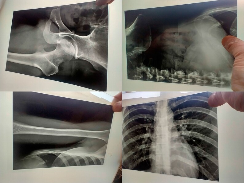 X-RAY Human Skeleton Puzzle Light Box Art Bones 230x159mm X22 Pieces ...