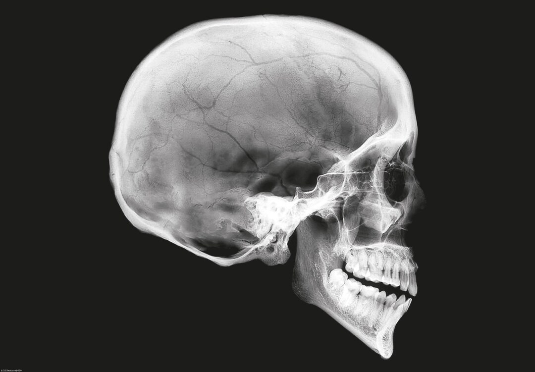 X-RAY Human SKULL Imaged on Photographic Film Light Box 227x160mm ...