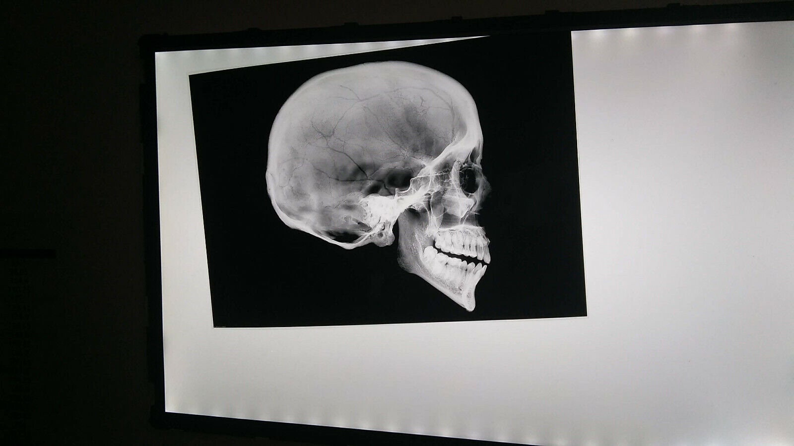 X-RAY Human SKULL Imaged on Photographic Film Light Box 227x160mm ...