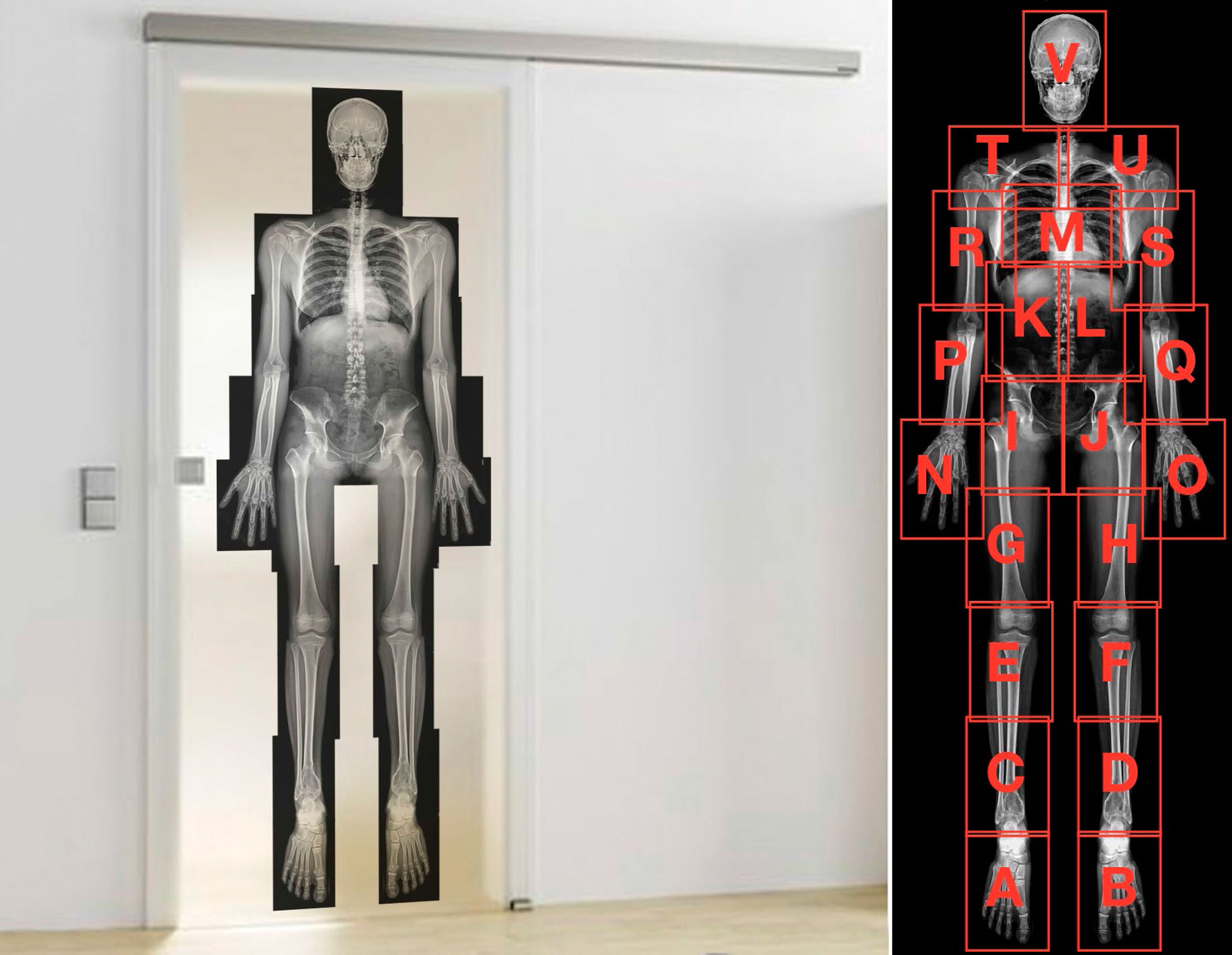 X-RAY Human Skeleton Puzzle Light Box Art Bones 230x159mm X22 Pieces ...