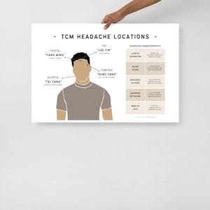 TCM HEADACHE Poster, Acupuncture Poster - Etsy