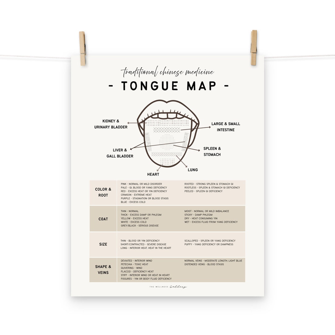 TCM Tongue Map Poster, Acupuncture Poster (off White Background) - Etsy