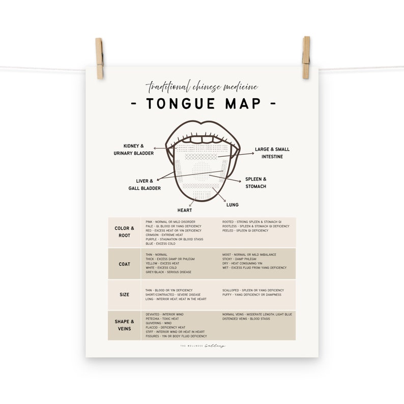 TCM Tongue Map Poster, Acupuncture Poster (off White Background) - Etsy