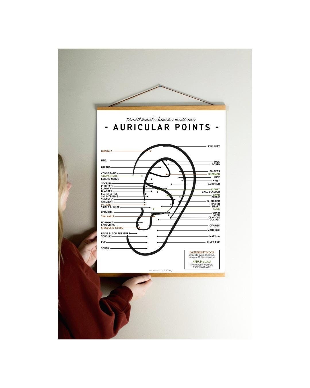 Auricular Acupuncture Poster - Etsy