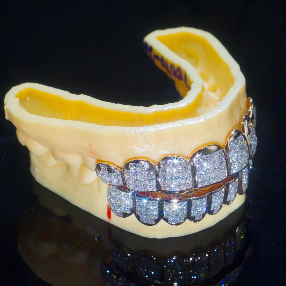 Moissanite Grillz, 8 Top & 8 Bottom Moissanite Grills, Custom Made Full ...