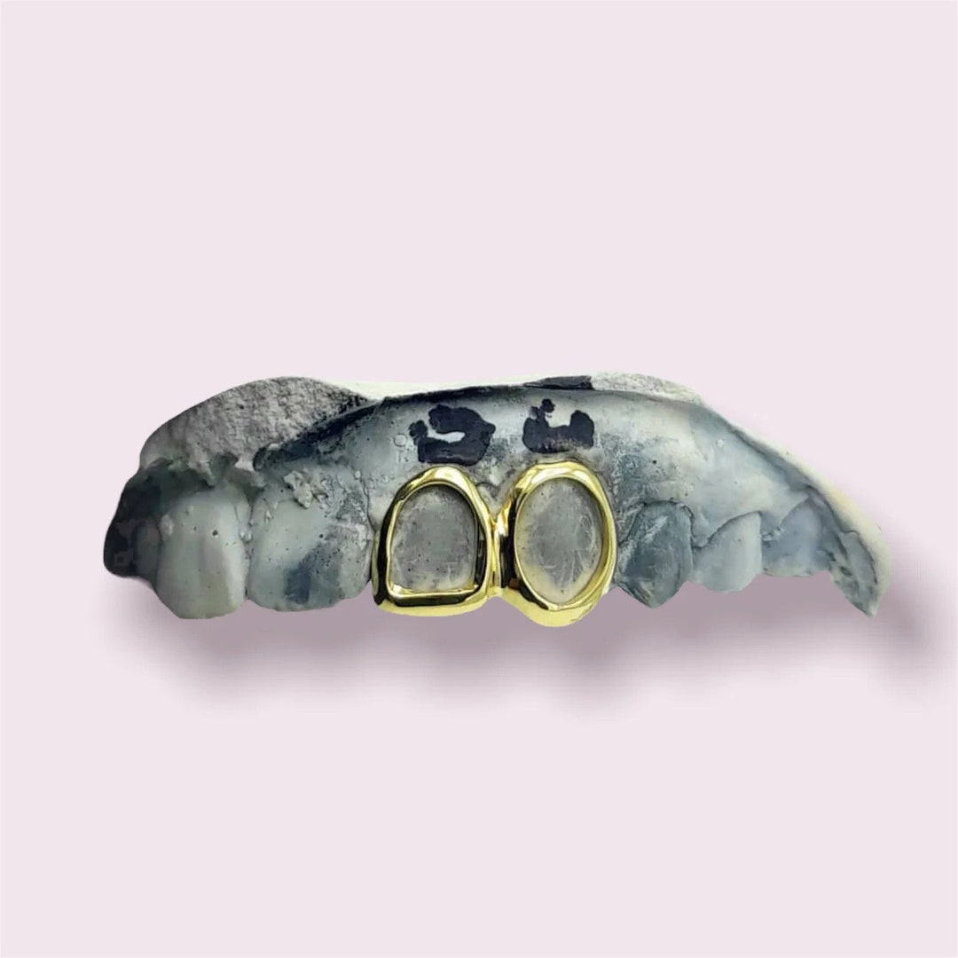 9ct Gold Window Grillz - Etsy