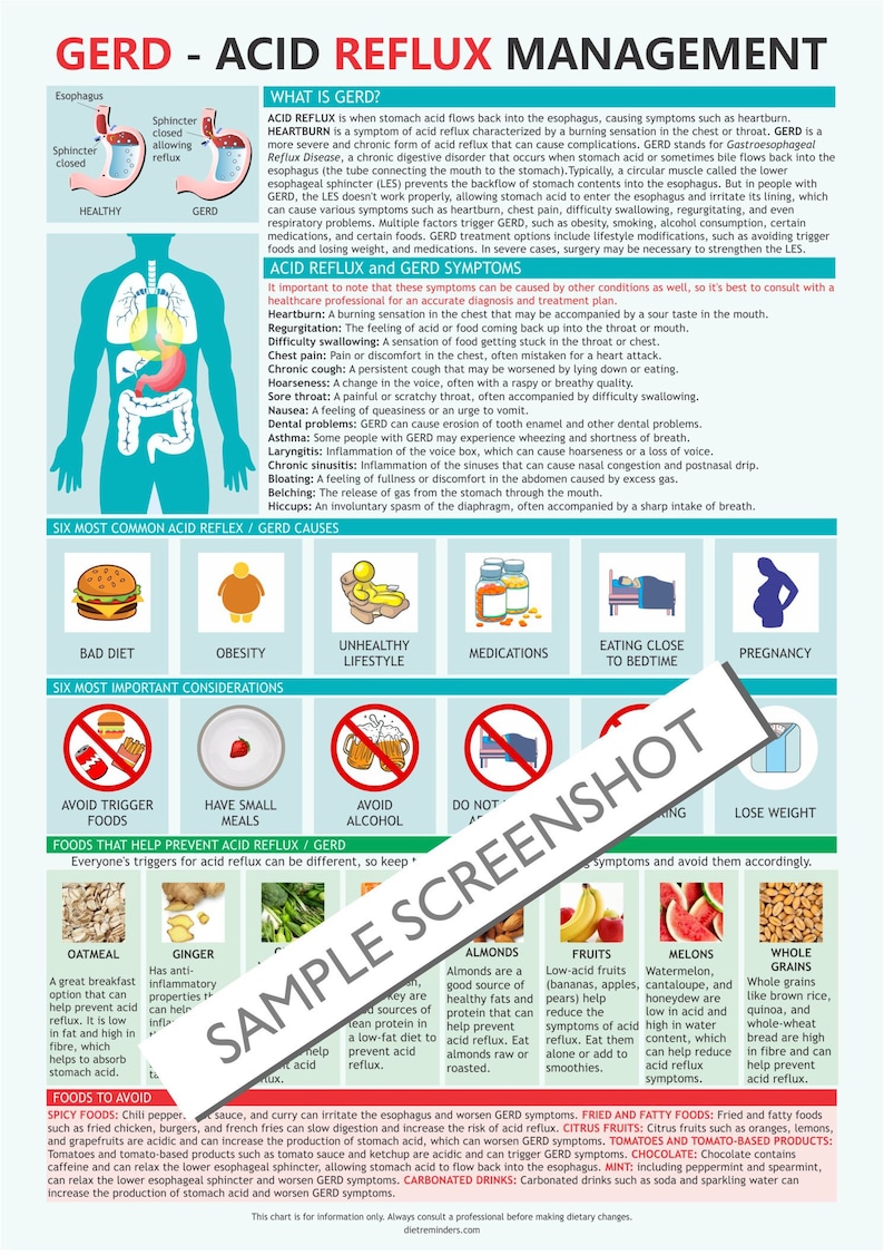Gerd-allowed Foods, Acid Reflux Chart, Heartburn Management Chart, Digital Download, Printable ...